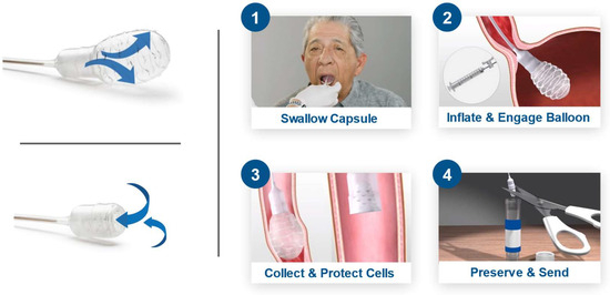 Real-World Clinical Utility of a Methylated DNA Biomarker Assay on ...