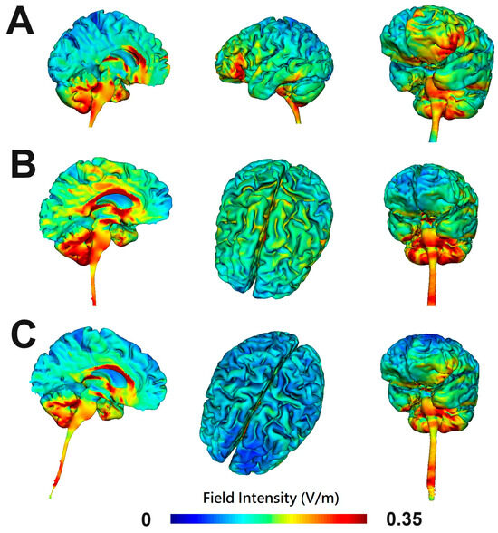 Comparing Different Montages of Transcranial Direct Current Stimulation in Treating Treatment ...