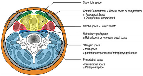 Management of Deep Neck Infection Associated with Descending ...