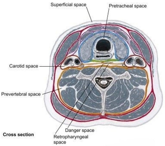 Management of Deep Neck Infection Associated with Descending ...