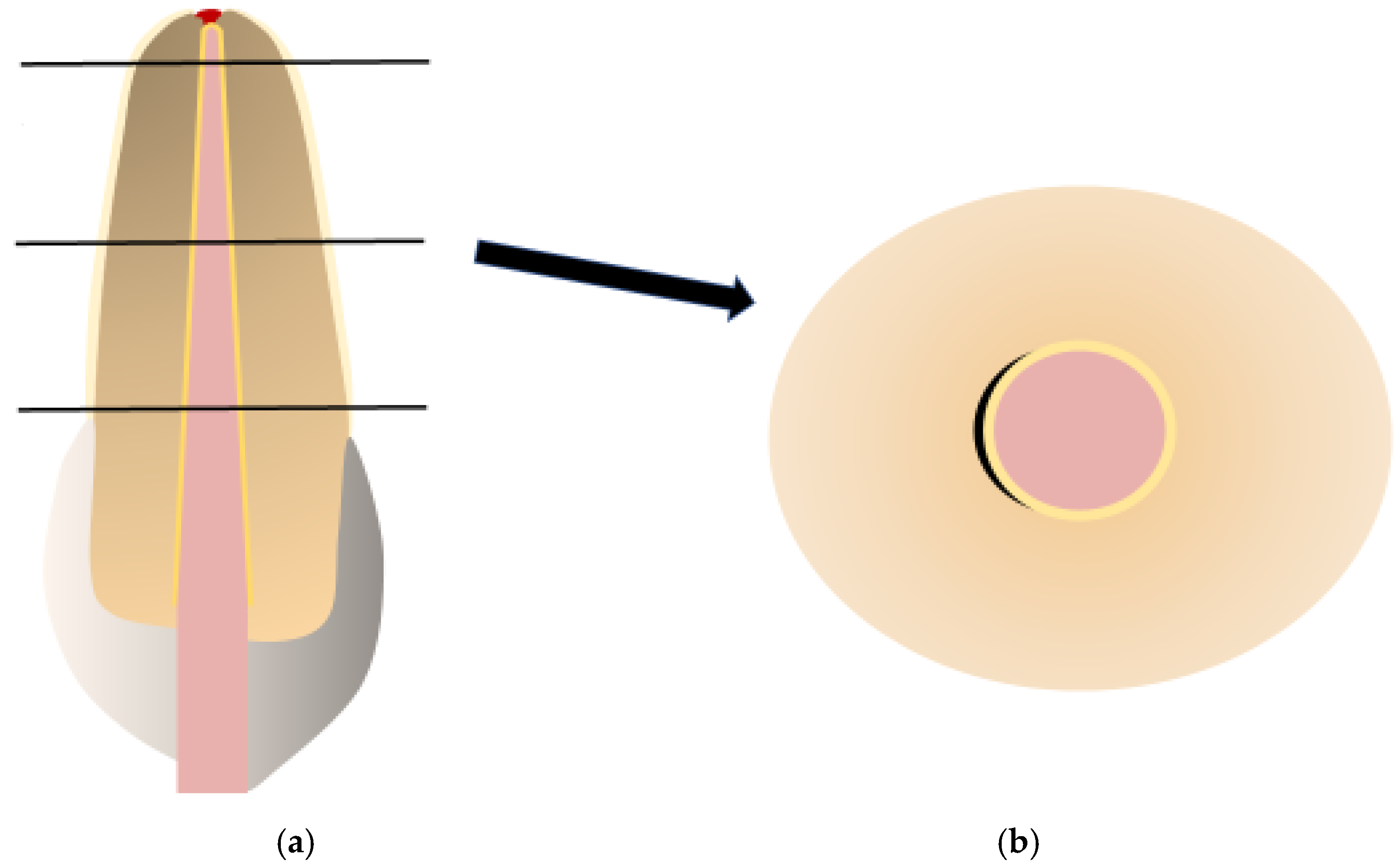 Quality of Single-Cone Obturation Using Different Sizes of Matching ...
