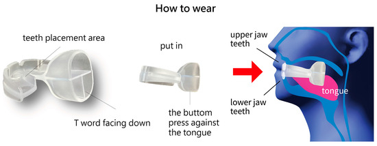 The Impact of a Tongue Training Device on Tongue Muscle Strength in ...
