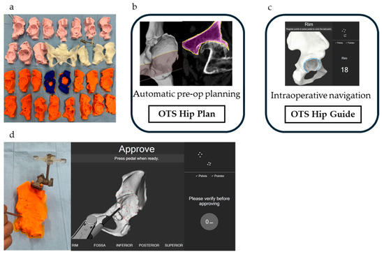 Accuracy Verification of a Computed Tomography-Based Navigation System ...