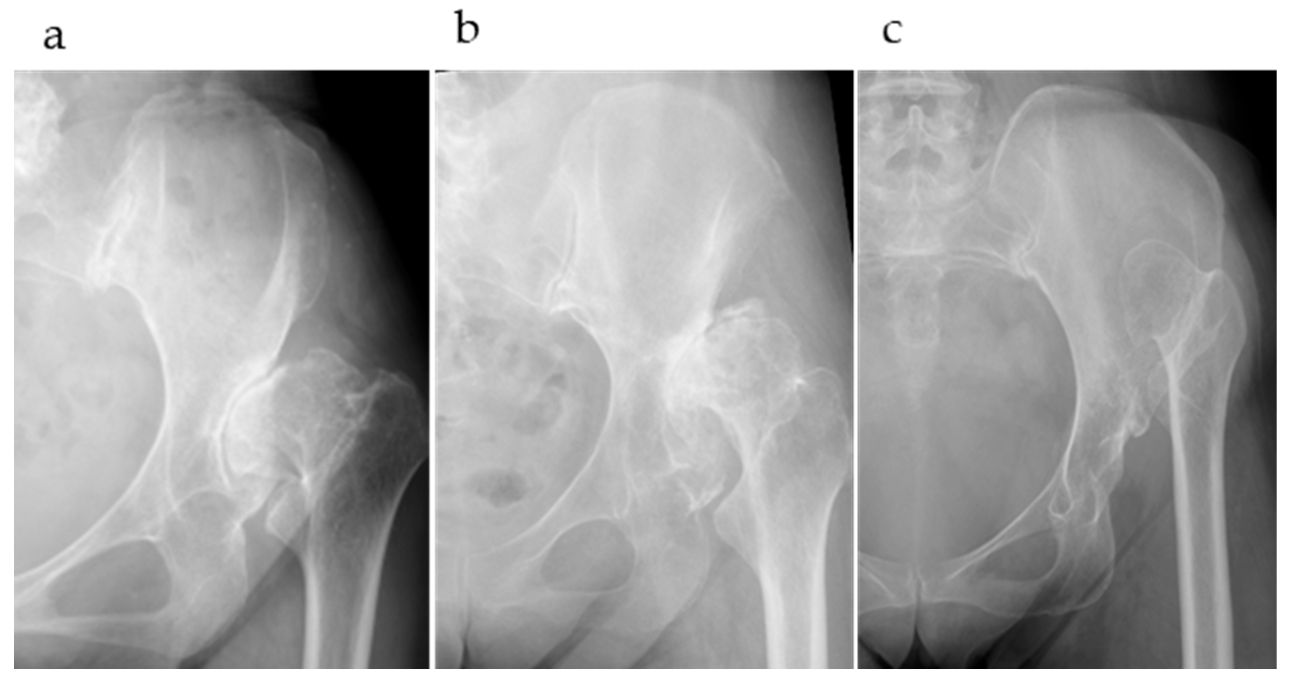 Accuracy Verification of a Computed Tomography-Based Navigation System ...