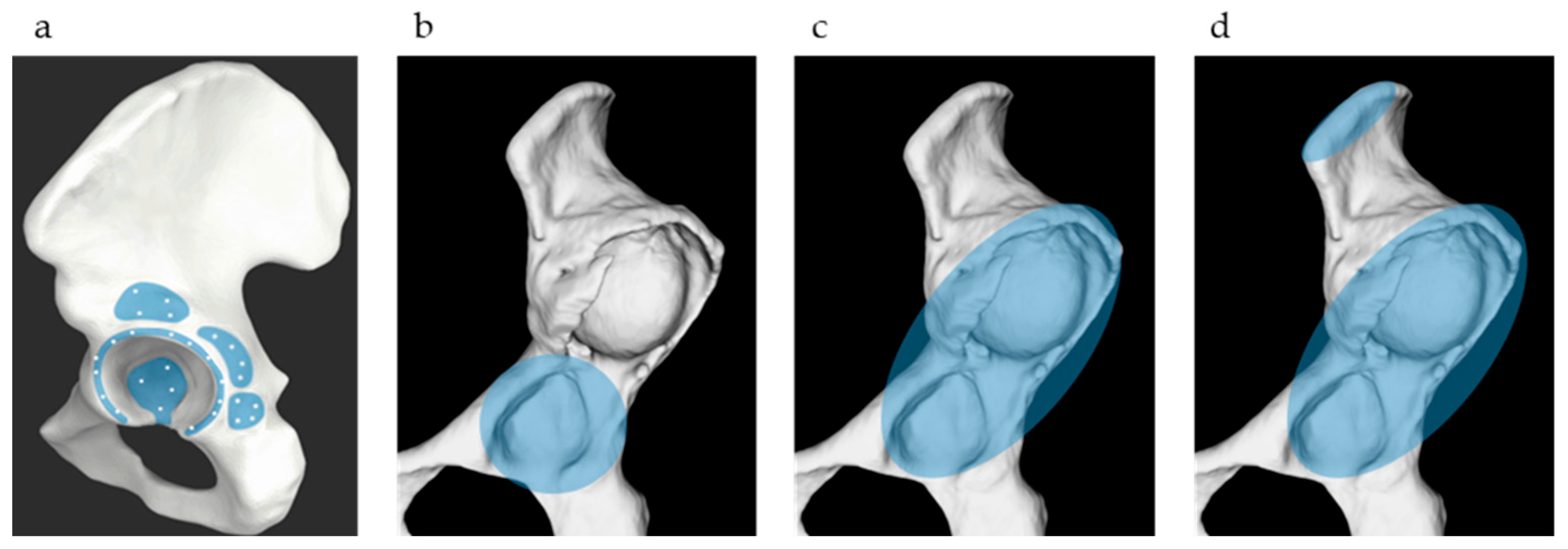Accuracy Verification of a Computed Tomography-Based Navigation System ...