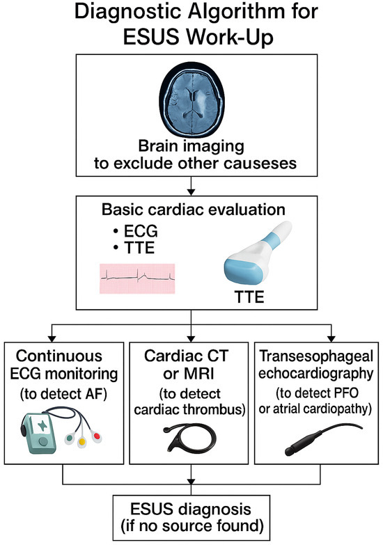 Embolic Stroke of Undetermined Source (ESUS): Exploring the ...
