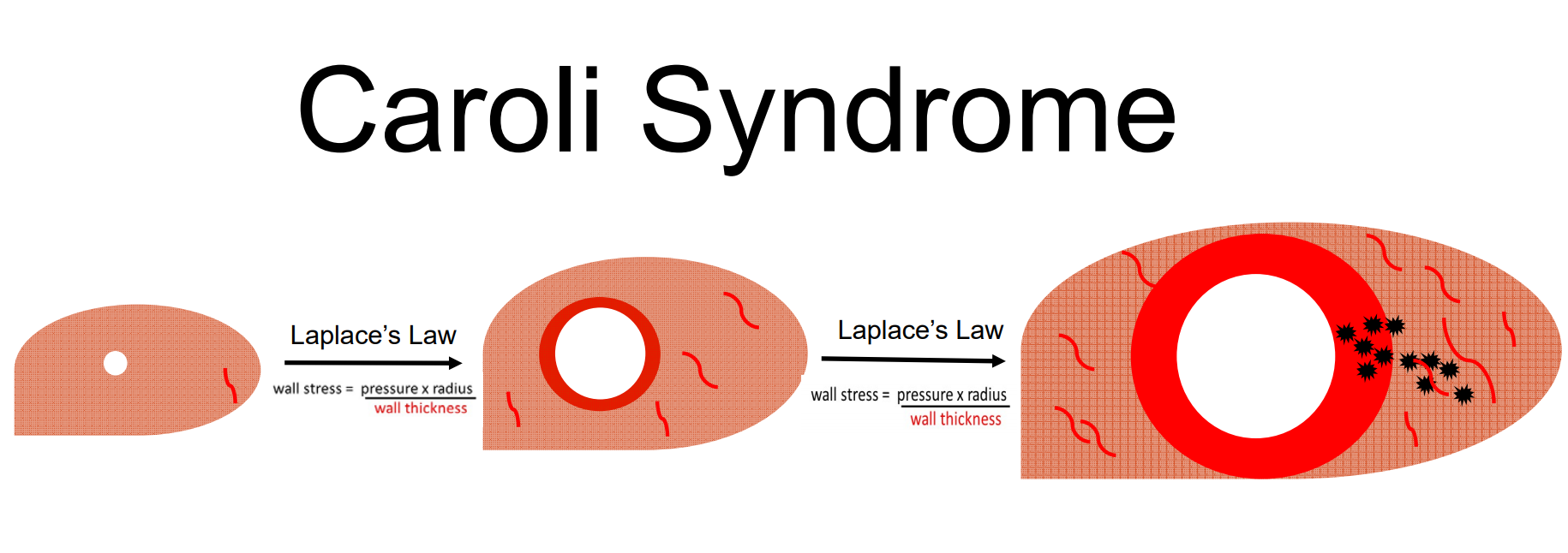 Medical Sciences | Free Full-Text | Remodeling of Intrahepatic Ducts in ...