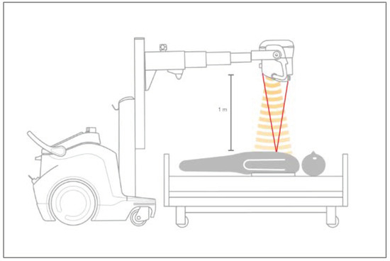 Portable Dynamic Chest Radiography: Literature Review and Potential ...