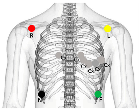 Positioning of the Central Venous Catheter for Hemodialysis Using ...
