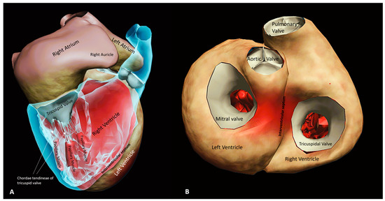 Right Heart Failure in Critical and Chronic Care: Current Concepts ...