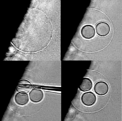 Membranes | Free Full-Text | Formation of Oligovesicular Vesicles by ...