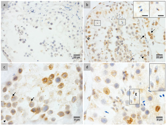 Descriptive Analysis of LAP1 Distribution and That of Associated ...