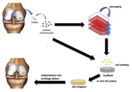 Review of Synthetic and Hybrid Scaffolds in Cartilage Tissue Engineering
