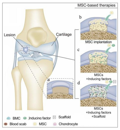 Review of Synthetic and Hybrid Scaffolds in Cartilage Tissue Engineering