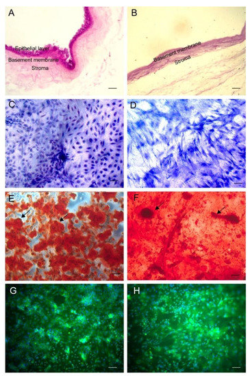 Adipose-Derived Stromal Cells and Mineralized Extracellular Matrix ...