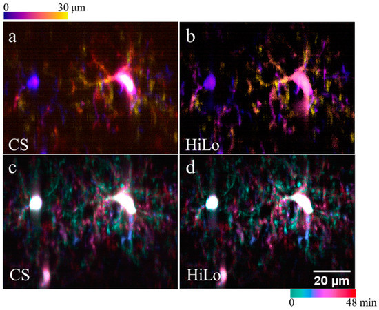 HiLo Based Line Scanning Temporal Focusing Microscopy for High-Speed ...
