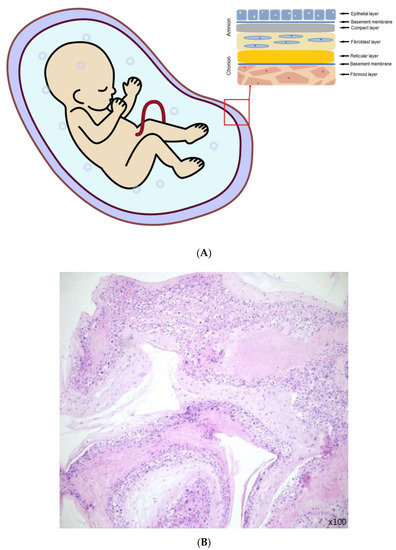 Membranes | Free Full-Text | Using of Amniotic Membrane Derivatives for ...
