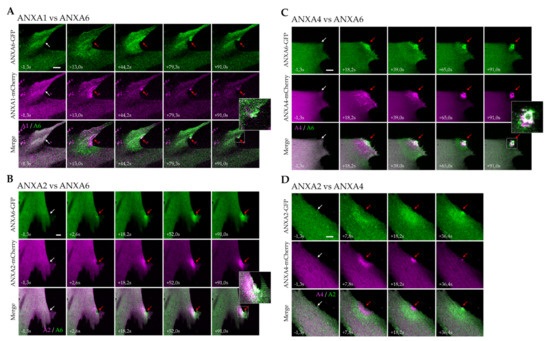 Trafficking of Annexins during Membrane Repair in Human Skeletal Muscle ...