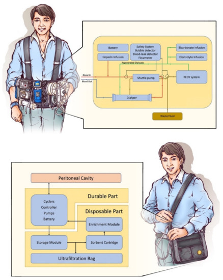 Artificial Kidney Engineering: The Development of Dialysis Membranes ...