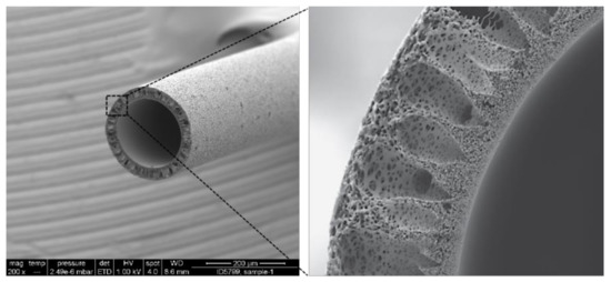 Effects of Expanded Hemodialysis with Medium Cut-Off Membranes on ...