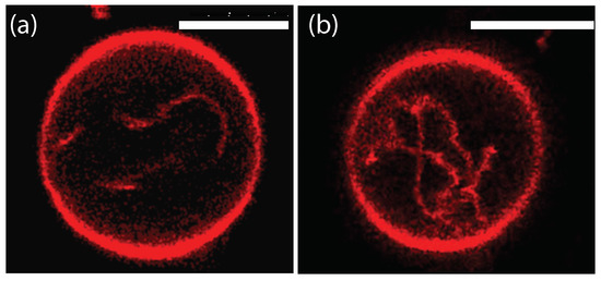 Remodeling of Biomembranes and Vesicles by Adhesion of Condensate Droplets