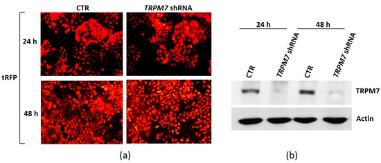 The Interplay between TRPM7 and MagT1 in Maintaining Endothelial ...