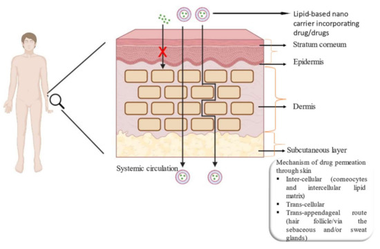 Potential of Lipid-Based Nanocarriers against Two Major Barriers to ...