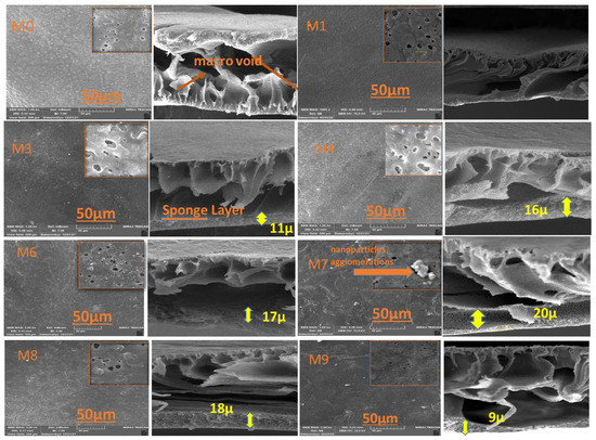 Effect of MAX Phase Ti3ALC2 on the Ultrafiltration Membrane Properties and Performance