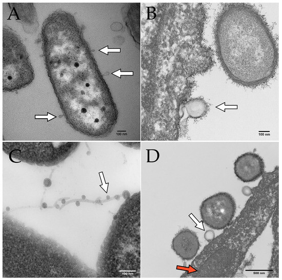 Bacterial Outer Membrane Vesicles and Immune Modulation of the Host