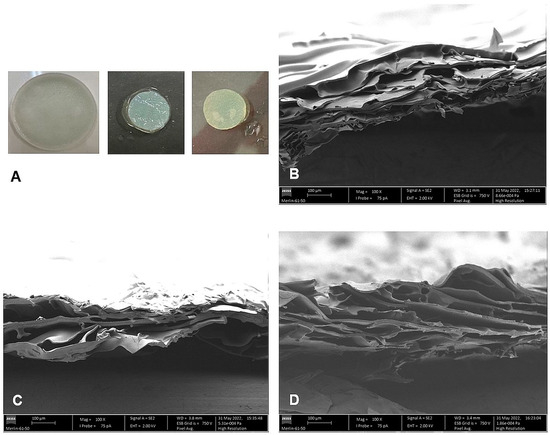 Sterilized Polyhexanide-Releasing Chitosan Membranes with Potential for ...