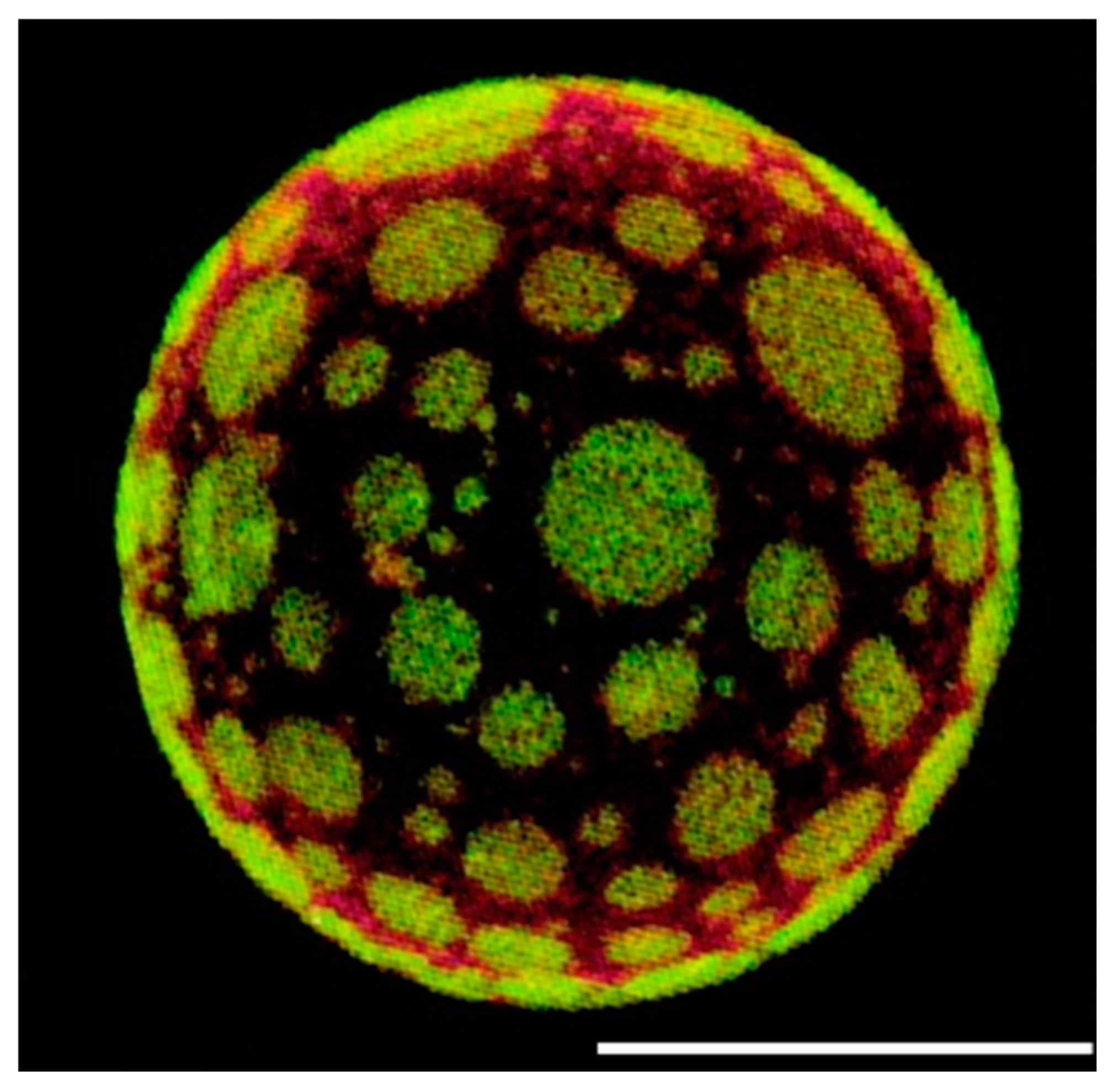 Lipid Rafts in Signalling, Diseases, and Infections: What Can Be ...