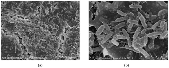 Bacterial Contamination of Ultrafiltration Installation Applied to ...