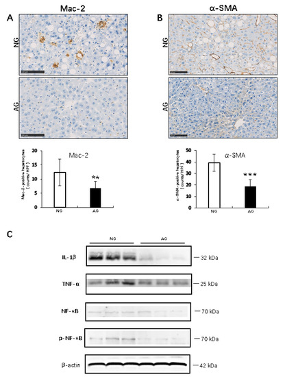 Acupuncture on ST36, CV4 and KI1 Suppresses the Progression of ...