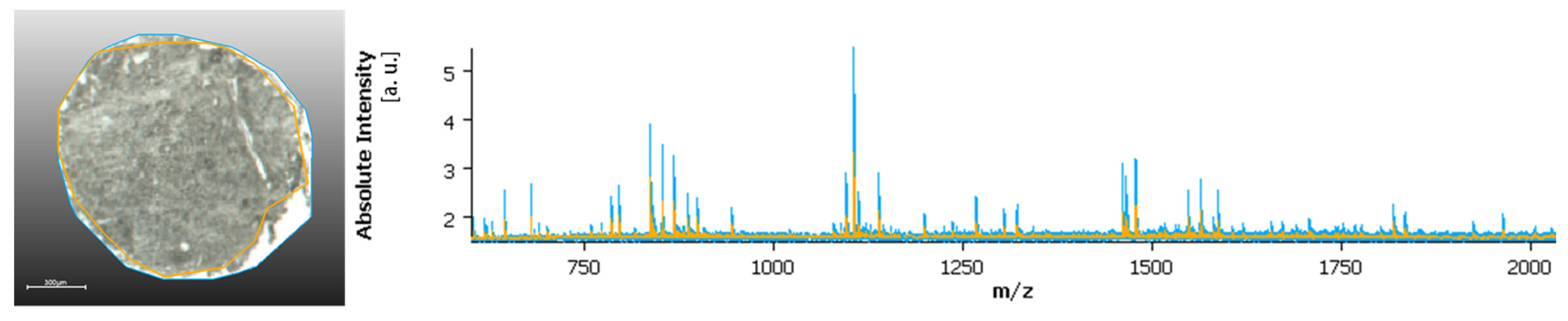 The Impact of Histological Annotations for Accurate Tissue ...