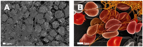 Metabolic Influences Modulating Erythrocyte Deformability and Eryptosis