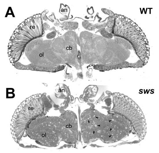 PNPLA6/NTE, an Evolutionary Conserved Phospholipase Linked to a Group ...