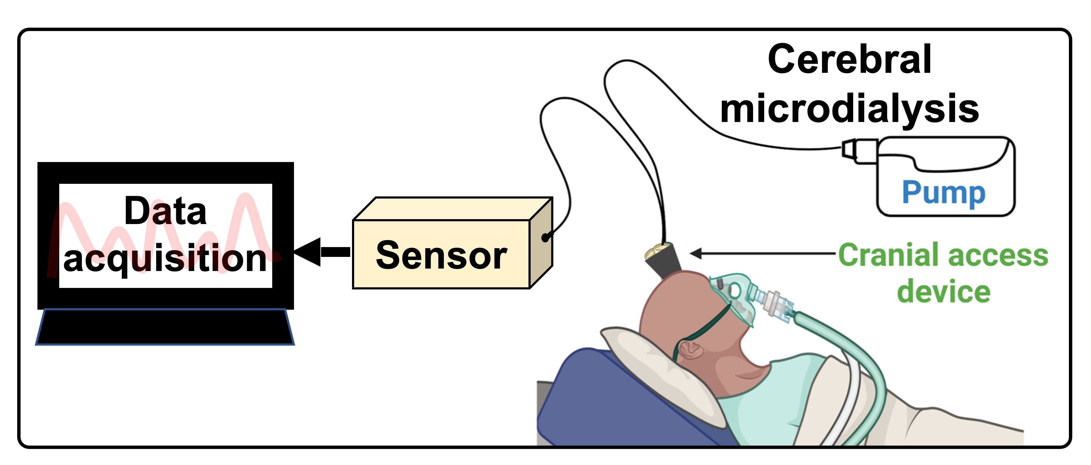Metabolites | Free Full-Text | Monitoring Neurochemistry in Traumatic ...