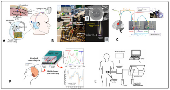 Monitoring Neurochemistry in Traumatic Brain Injury Patients Using ...