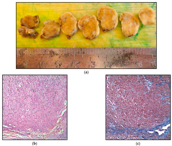 Metabolites Free Full Text The Leydig Steroid Cell Tumor In A