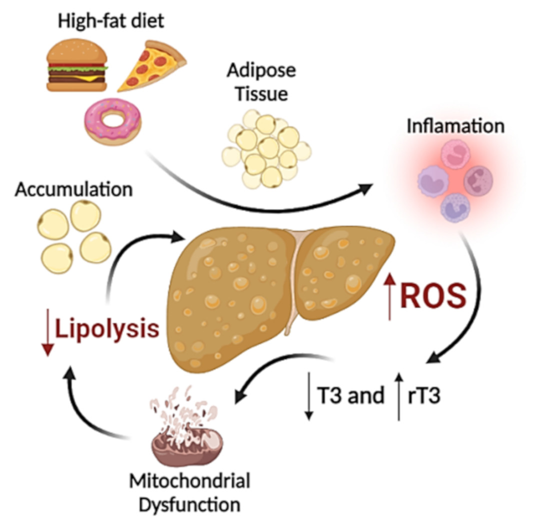 Metabolites | Free Full-Text | Influence of Altered Thyroid Hormone ...