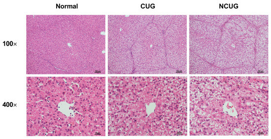 Altered Liver Metabolism, Mitochondrial Function, Oxidative Status, and ...