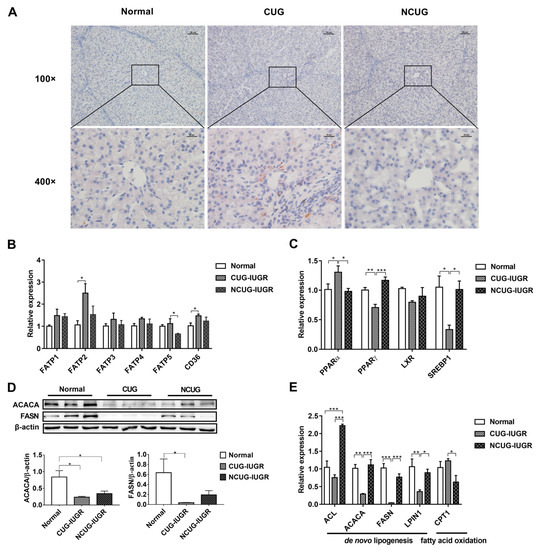 Altered Liver Metabolism, Mitochondrial Function, Oxidative Status, and ...