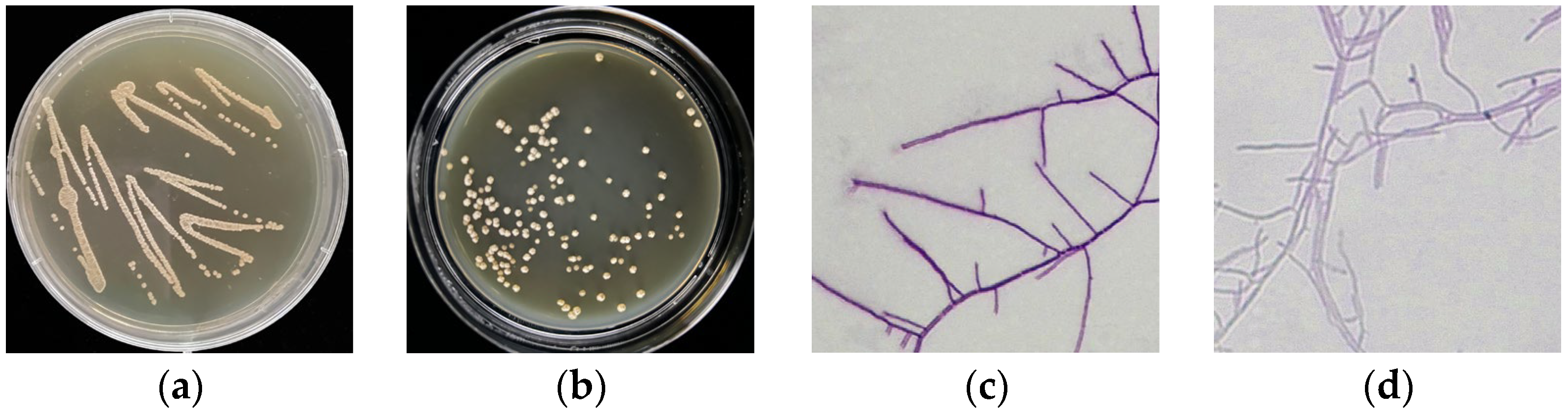 Comparative Transcriptome Analysis of Two Chrysomycin-Producing Wild ...