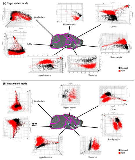 Investigation of Phospholipid Differences in Valproic Acid-Induced ...