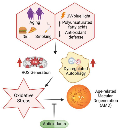 Role of Oxidative Stress in Ocular Diseases: A Balancing Act
