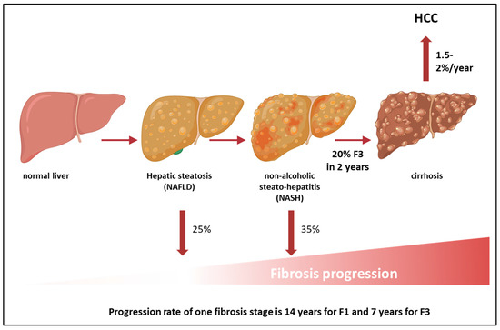 Screening for NAFLD—Current Knowledge and Challenges