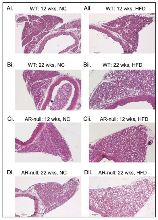 Metabolites | Free Full-Text | Aldose Reductase (AR) Mediates and ...