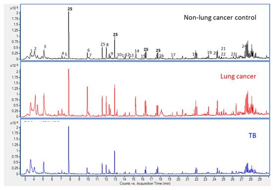 Breath Analysis for Lung Cancer Early Detection—A Clinical Study