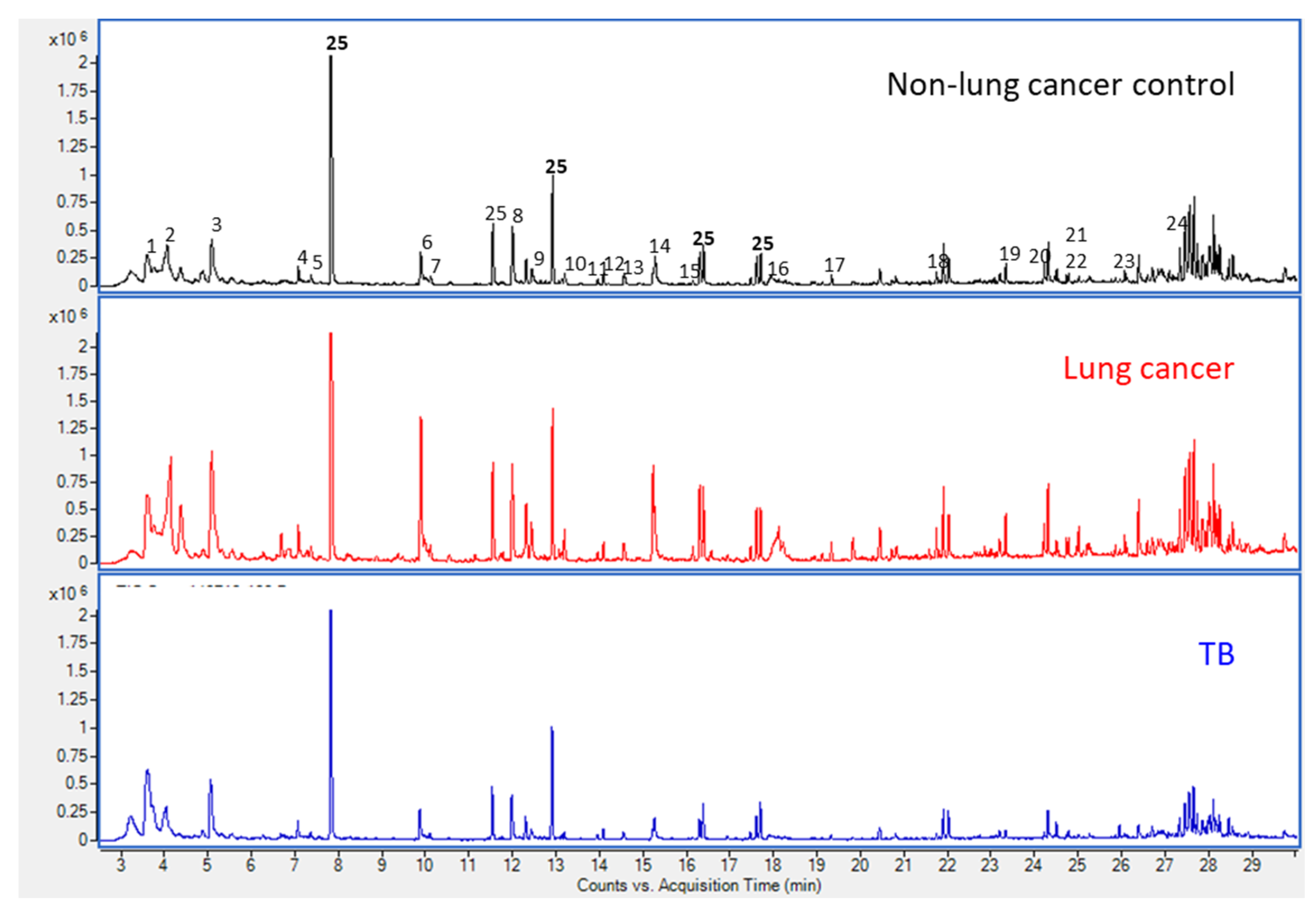 Breath Analysis for Lung Cancer Early Detection—A Clinical Study