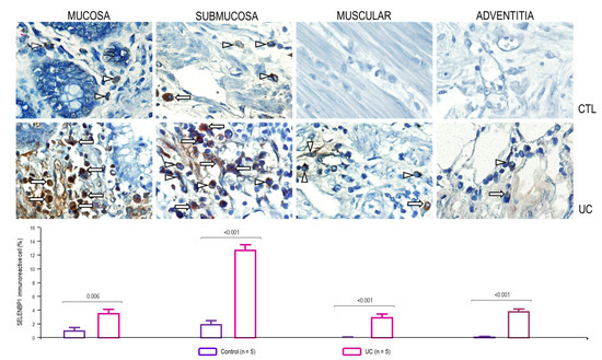 Protective Role of Selenium-Binding Protein 1 (SELENBP1) in Patients ...